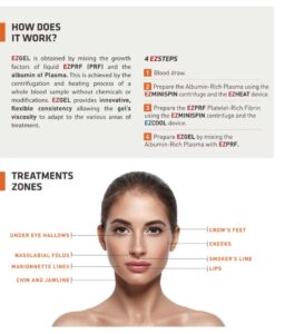 2nd Generation PRP: Platelet Rich Fibrin (PRF) in Whitefish MT